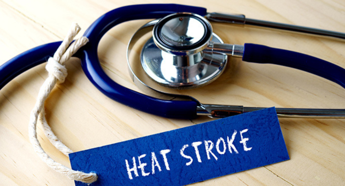 What is the Proper Treatment for Heat Stroke